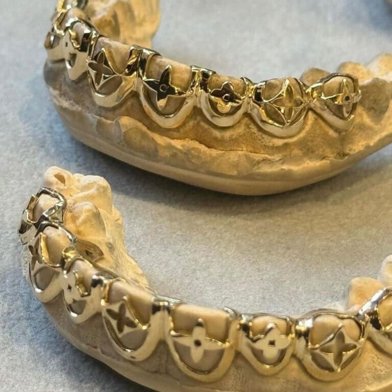 Gold braces at Louis Vuitton Fall 2024-2025 - RUNWAY MAGAZINE ® Official